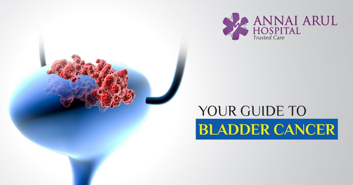 YOUR GUIDE TO BLADDER CANCER – Multispeciality Hospitals in Chennai