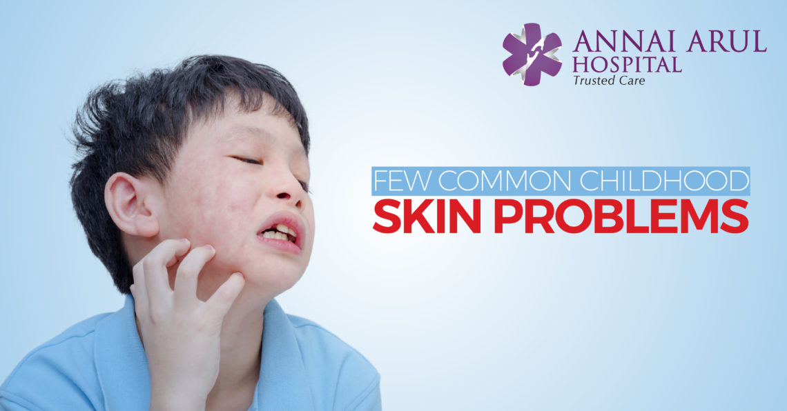 FEW COMMON CHILDHOOD SKIN PROBLEMS – Multispeciality Hospitals in Chennai