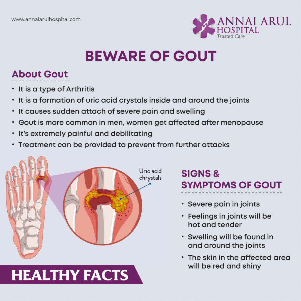 Beware of GOUT – Multispeciality Hospitals in Chennai