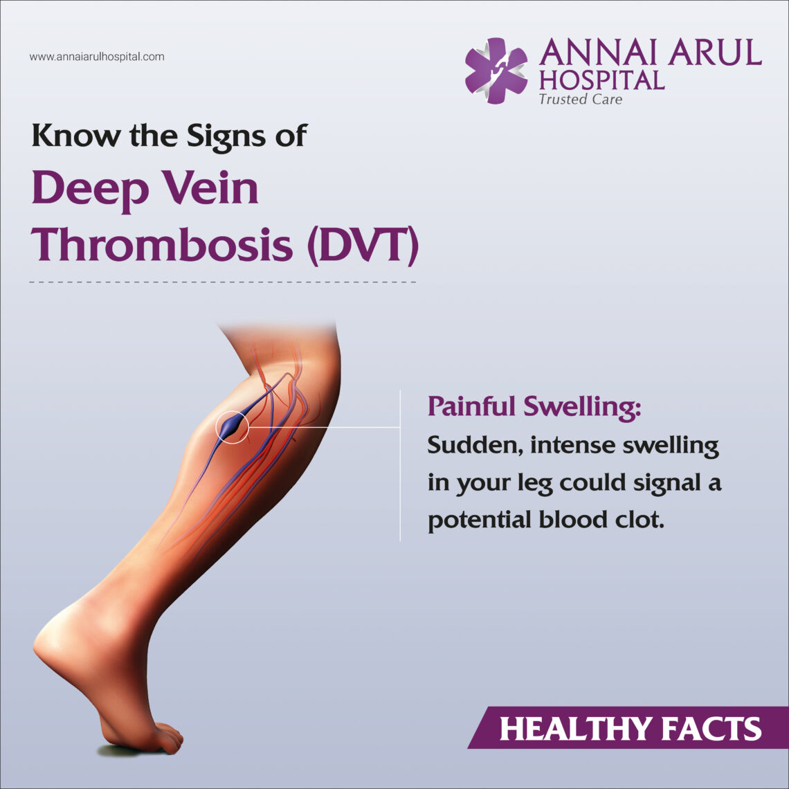 Know the Signs of Deep Vein Thrombosis (DVT) – Multispeciality ...