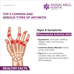 Top 5 Common and Serious Types of Arthritis: Signs & Symptoms ...